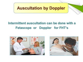 Electronic Fetal Heart Rate Monitoring for Nursing students | PDF