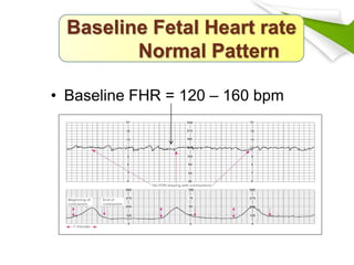 Electronic Fetal Heart Rate Monitoring for Nursing students | PDF