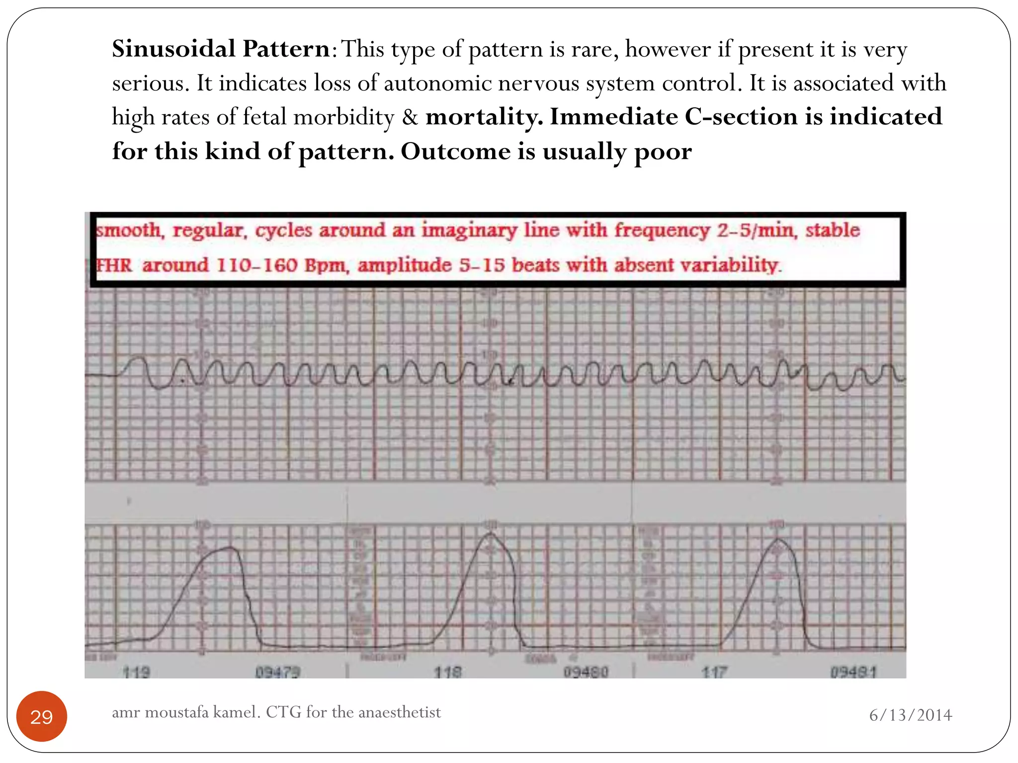 CTG for the anaesthetist | PPTX