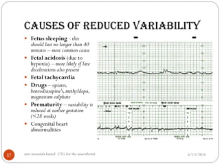 CTG for the anaesthetist | PPTX