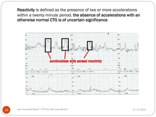 CTG for the anaesthetist | PPTX