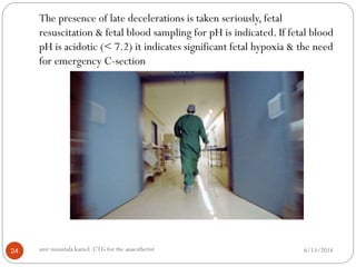 CTG for the anaesthetist | PPTX