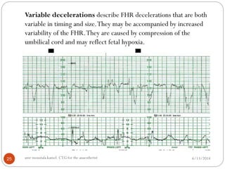 CTG for the anaesthetist | PPTX