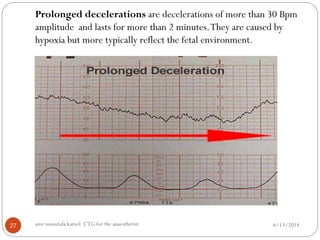 CTG for the anaesthetist | PPTX