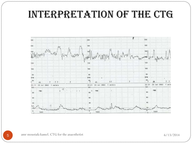 CTG for the anaesthetist | PPTX | Pregnancy | Reproductive Health