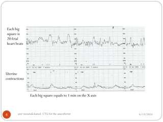CTG for the anaesthetist | PPTX