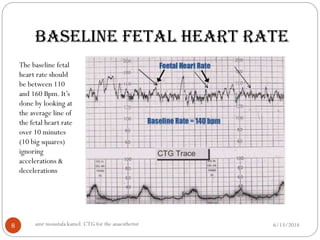 CTG for the anaesthetist | PPTX