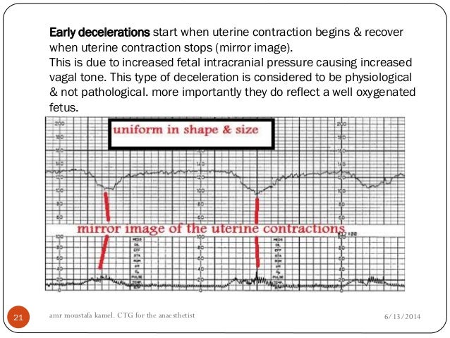 CTG for the anaesthetist