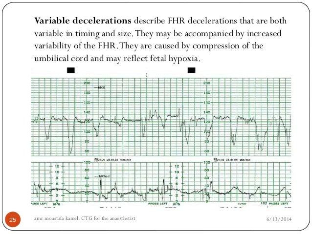 CTG for the anaesthetist