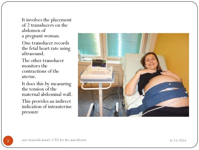 CTG for the anaesthetist