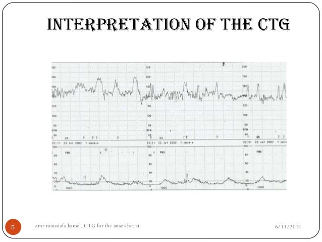 CTG for the anaesthetist