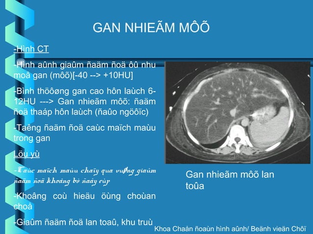 Ct giai phau bung & u gan | PPT