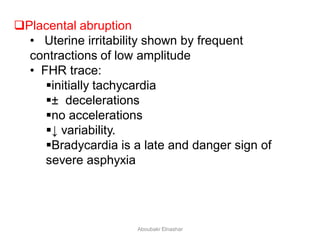 CTG: Interpretation and management | PDF