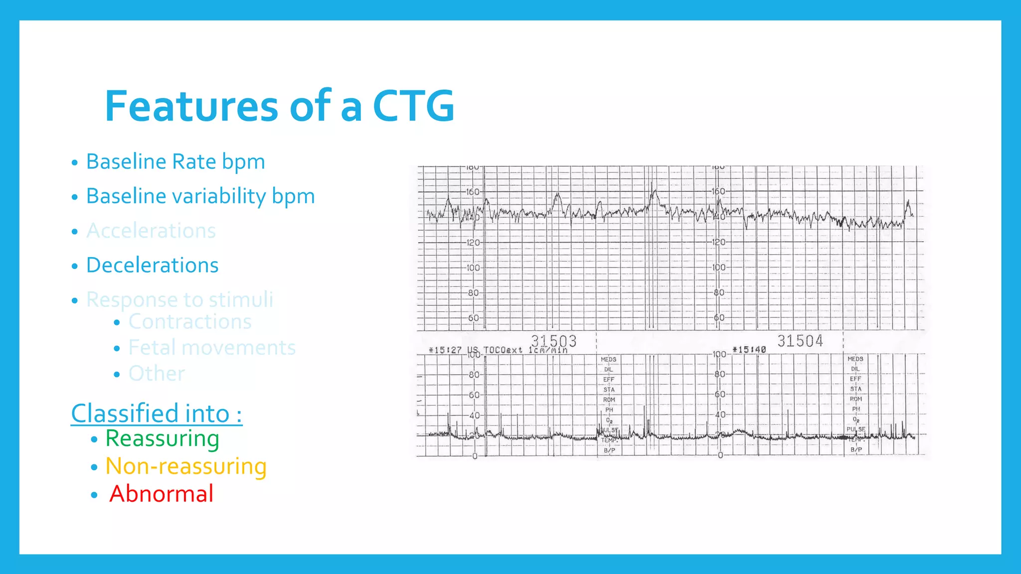 CTG Interpretation .pptx