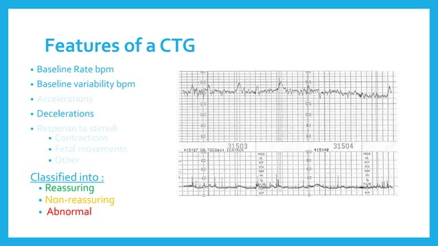 CTG Interpretation .pptx