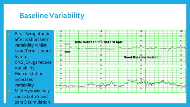 CTG Interpretation .pptx