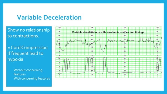 CTG Interpretation .pptx