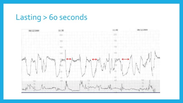 CTG Interpretation .pptx