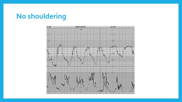 CTG Interpretation .pptx