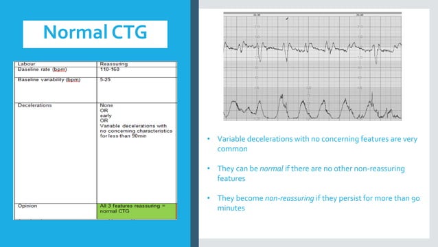 CTG Interpretation .pptx