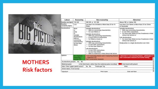 CTG Interpretation .pptx