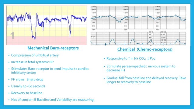 CTG Interpretation .pptx