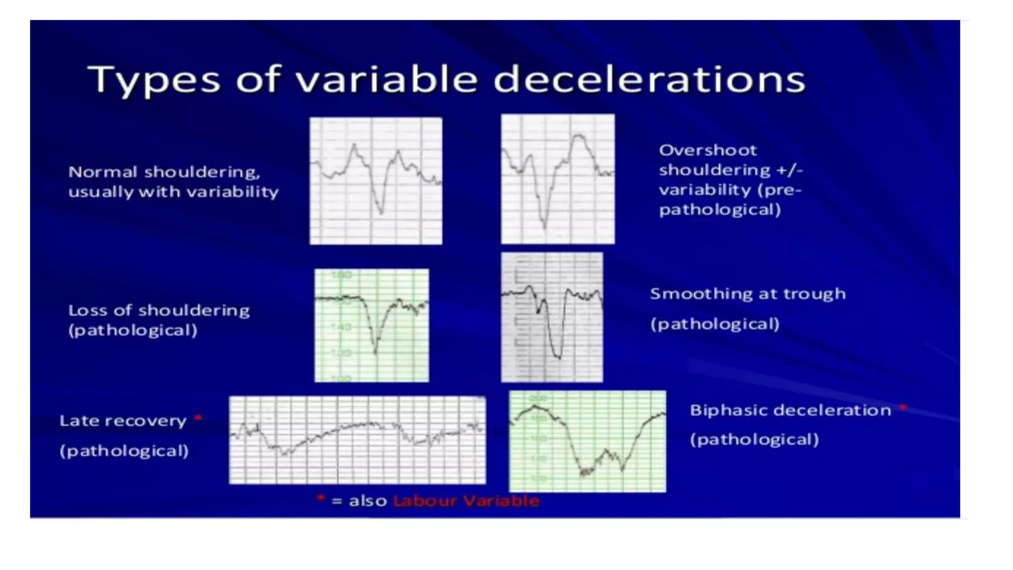 CTG INterpretation.pptx