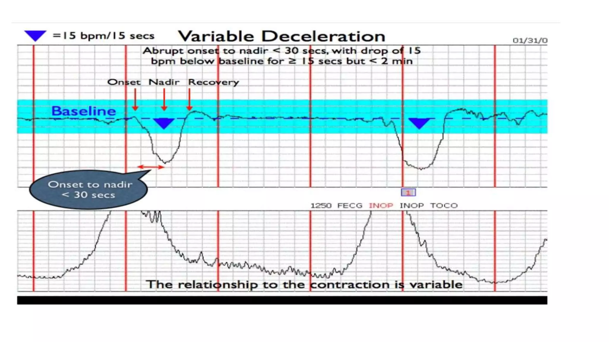 CTG INterpretation.pptx