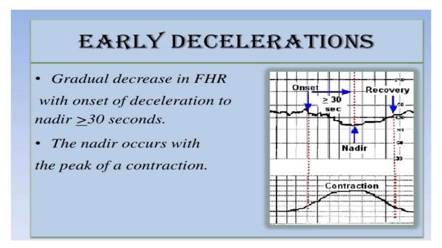 CTG INterpretation.pptx | Pregnancy | Reproductive Health
