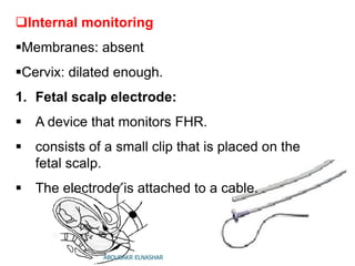 CTG introduction | PDF