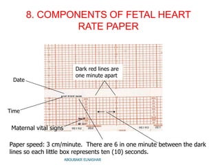 CTG introduction | PDF
