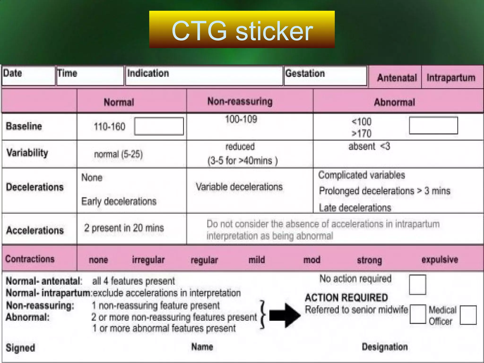 CTG Monitoring | PPT