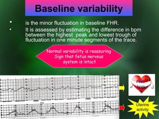 CTG Monitoring | PPT