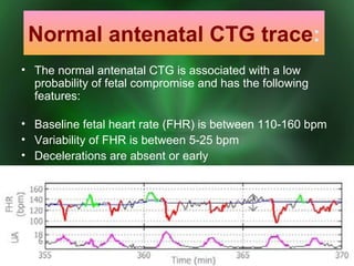 CTG Monitoring | PPT