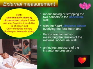 CTG Monitoring | PPT