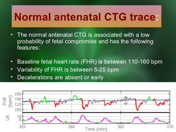 CTG Monitoring