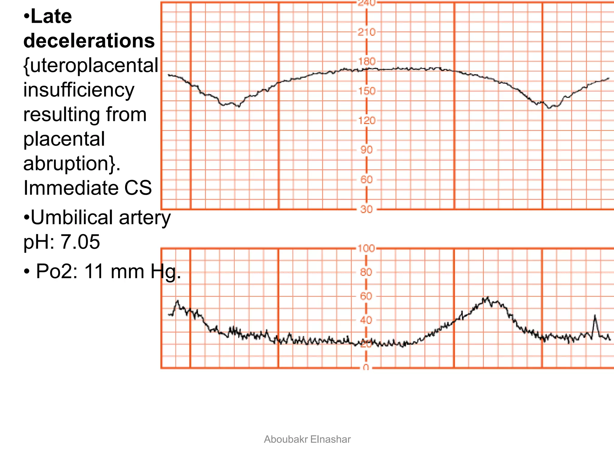 CTG: patterns | PDF