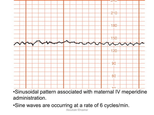 CTG: patterns | PDF