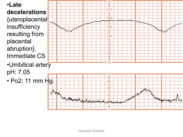 CTG: patterns | PDF