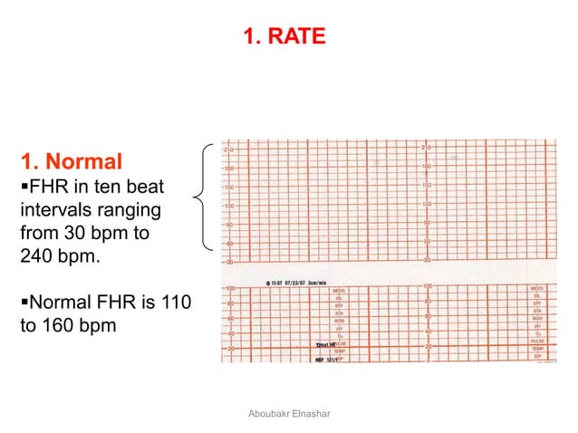 CTG: patterns | PDF
