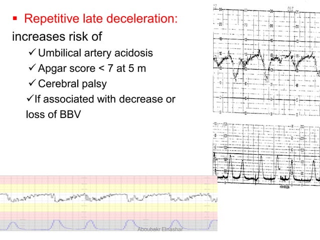 CTG: patterns | PDF