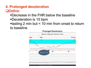 Deceleration Definition