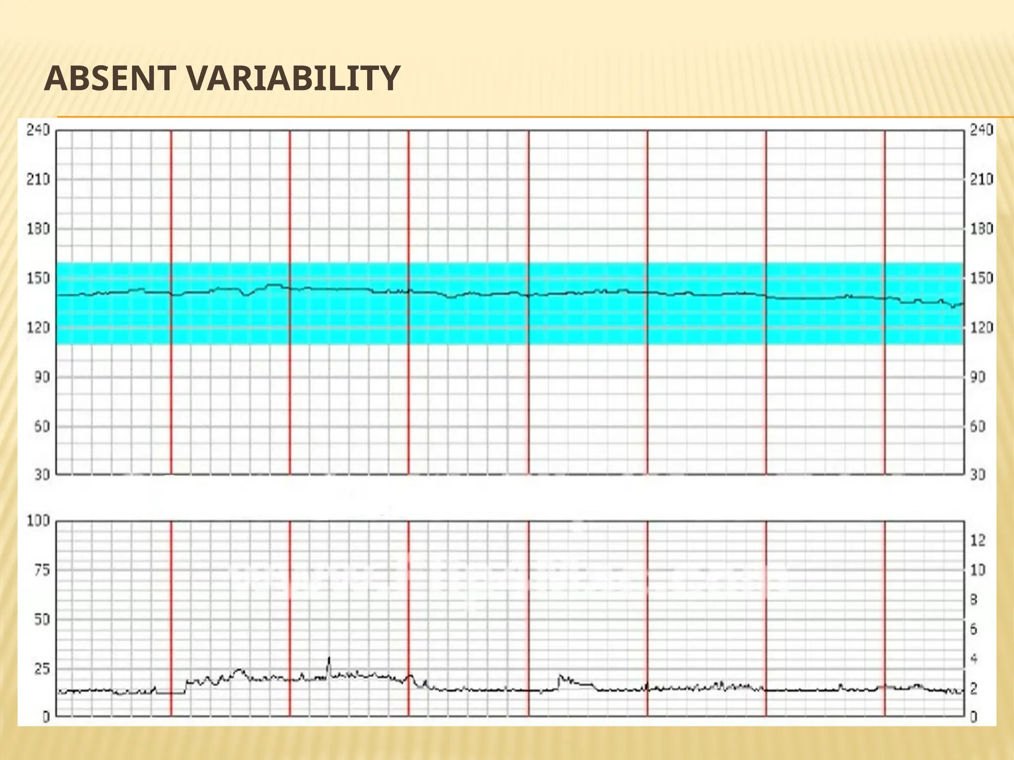 Fetal monitoring in labour PRESENTATION.pptx