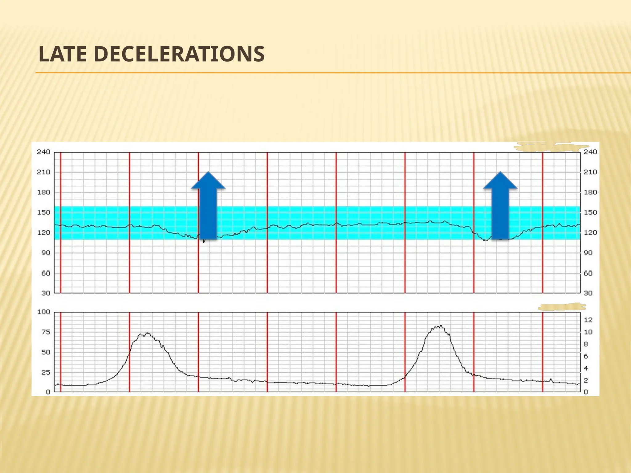Fetal Monitoring In Labour Presentation Pptx
