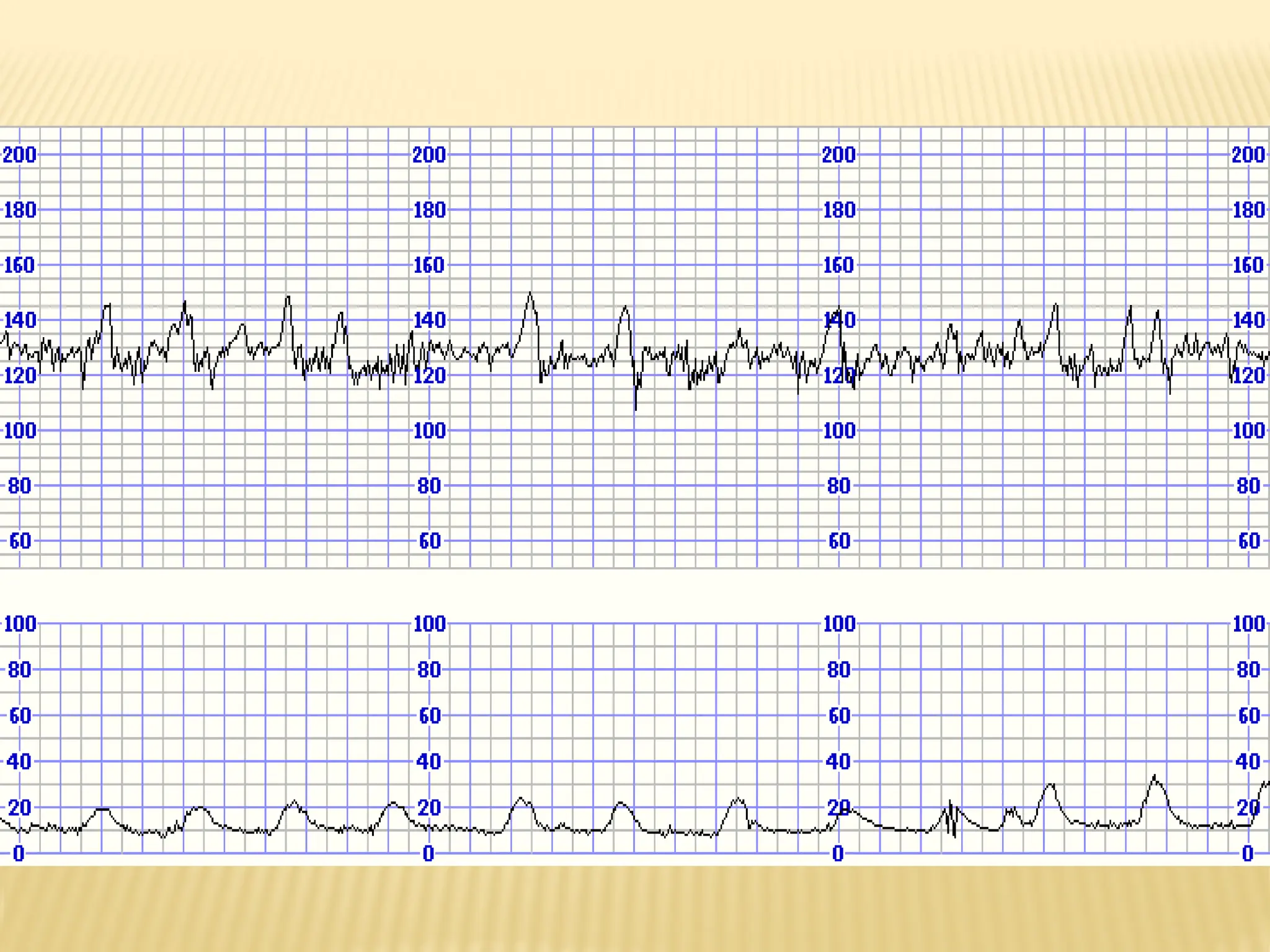 Fetal monitoring in labour PRESENTATION.pptx