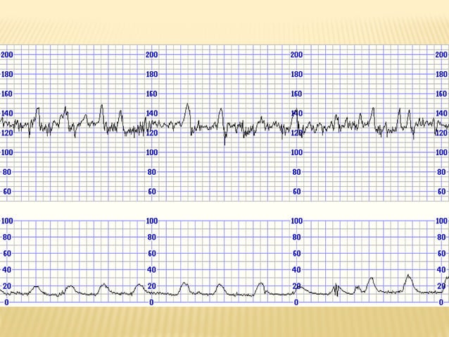 Fetal monitoring in labour PRESENTATION.pptx
