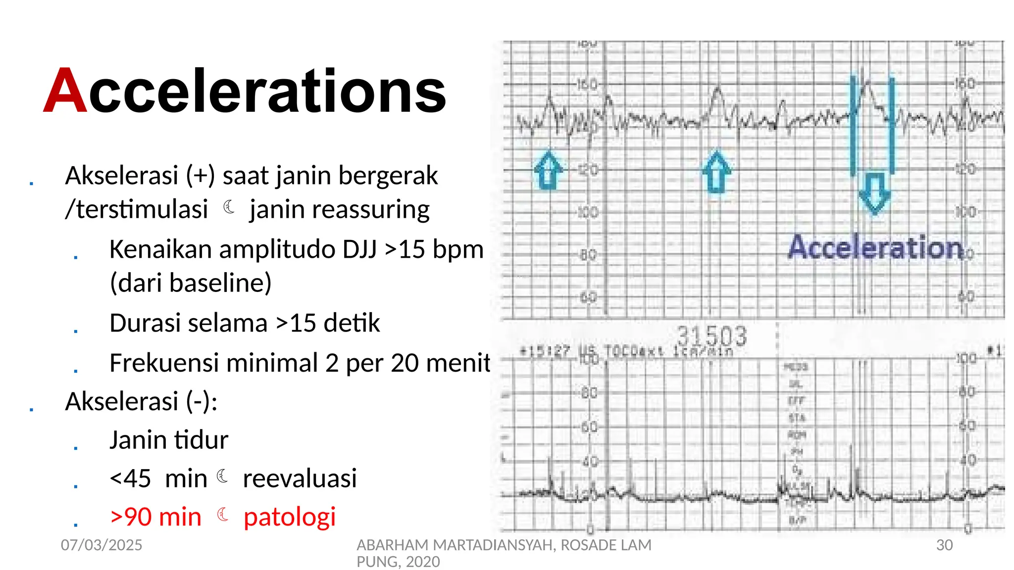 basic cardiotocography skill for daily use.pptx