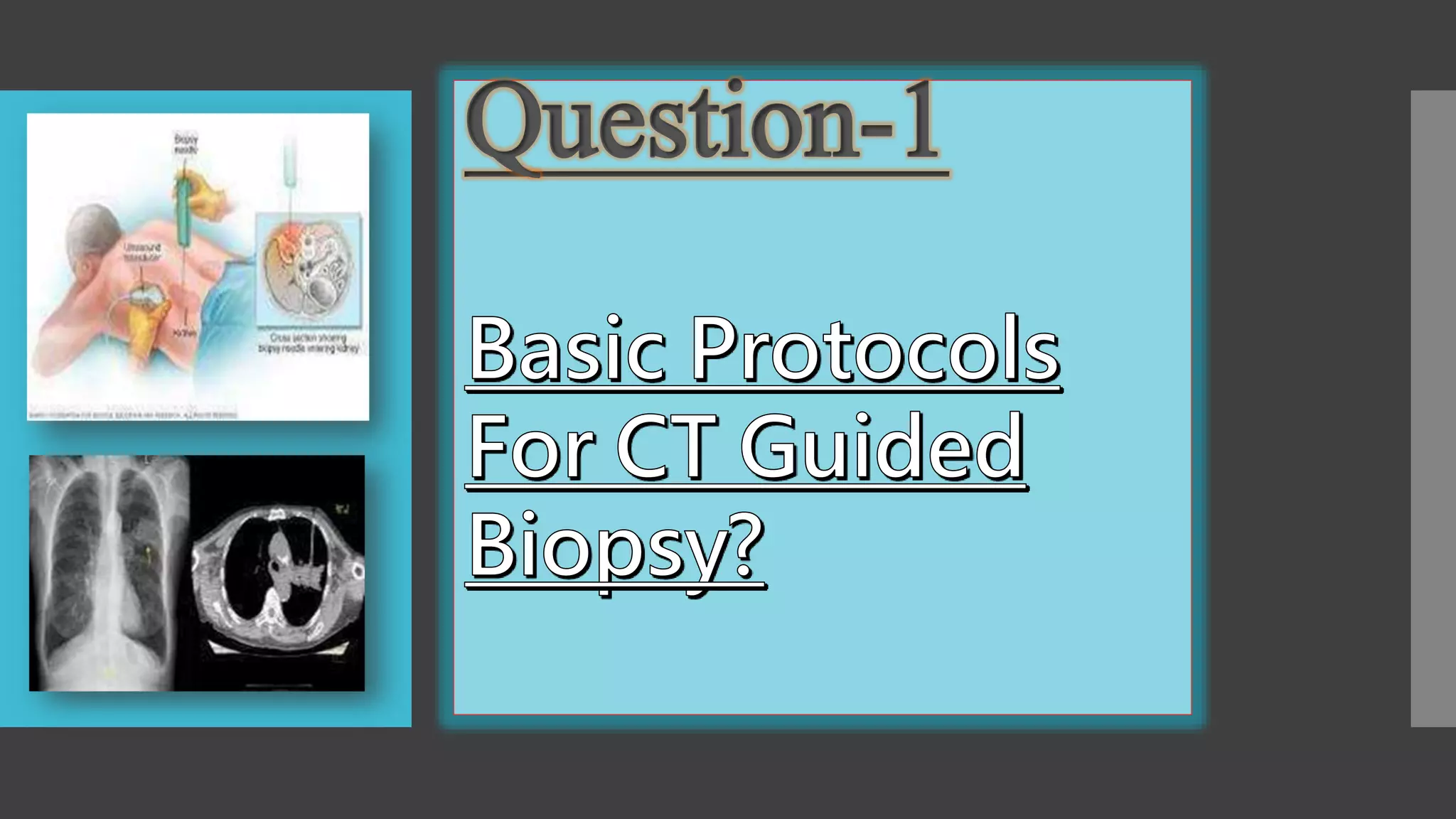 CT Guided Biopsy.pptx