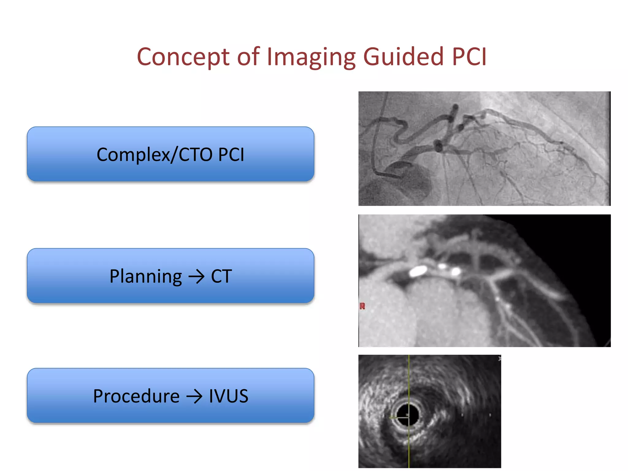 CT guided CTO PCI | PPTX