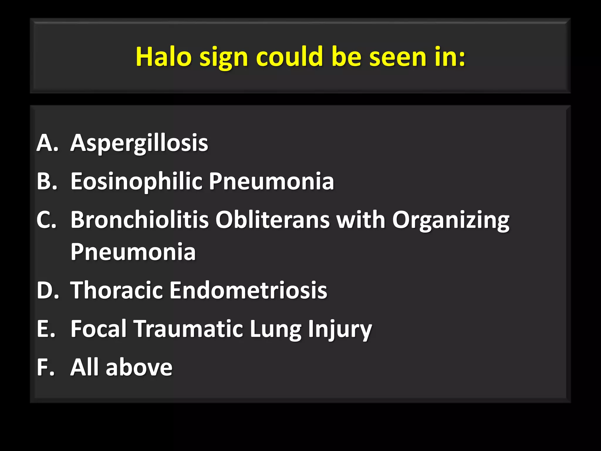 Ct halo sign (part 1) | PPTX